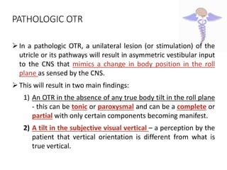 Ocular tilt reaction and skew deviation | PPTX