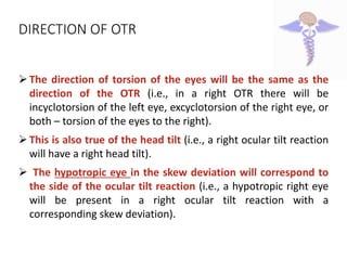 Ocular tilt reaction and skew deviation | PPTX