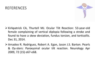 Ocular tilt reaction and skew deviation | PPTX