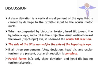 Ocular tilt reaction and skew deviation | PPTX