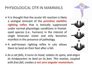 Ocular tilt reaction and skew deviation | PPT