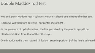 Ocular torsion | PPT