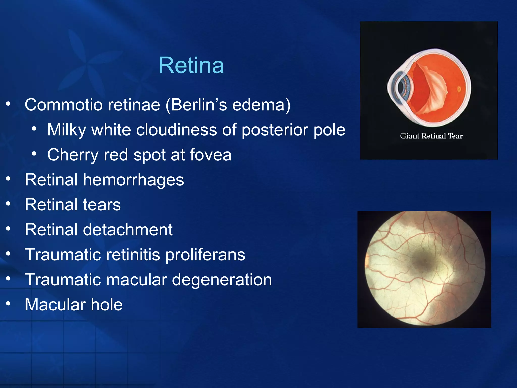 Ocular trauma | PPT