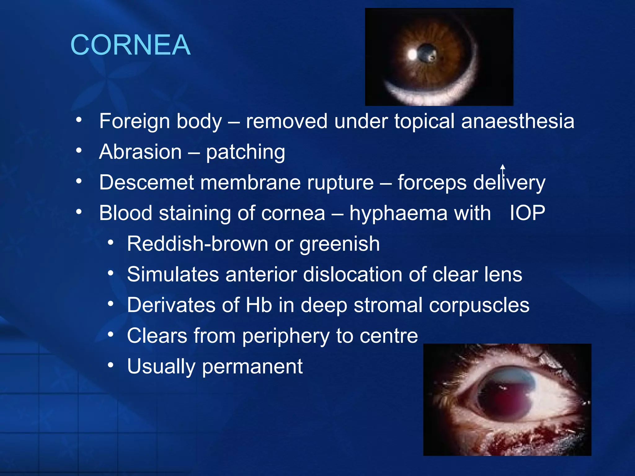 Ocular trauma | PPT