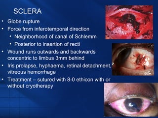 Ocular trauma | PPT