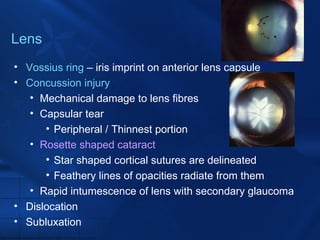 Ocular trauma | PPT