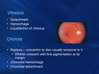 Ocular trauma | PPT