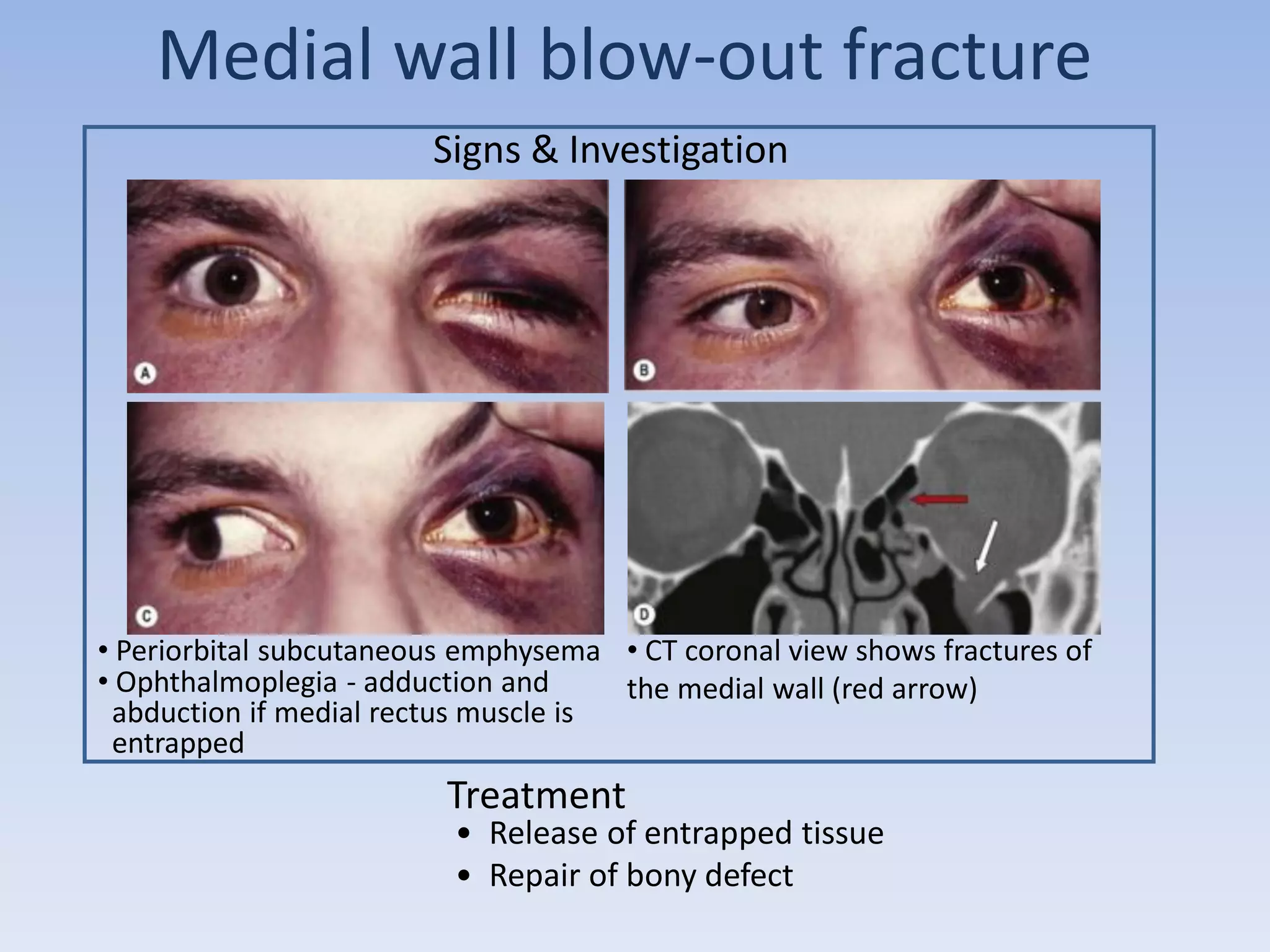 Ocular trauma | PDF