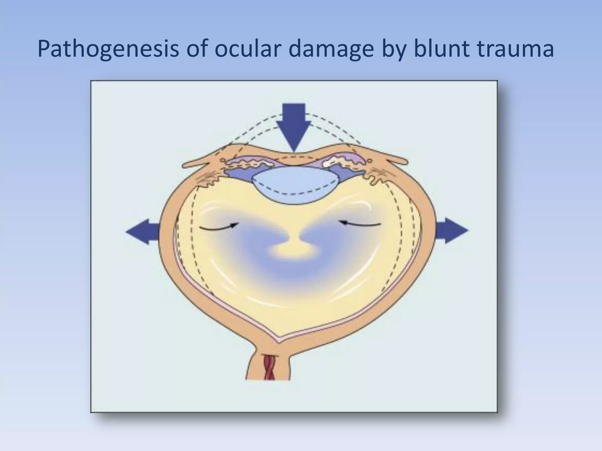 Ocular trauma | PDF