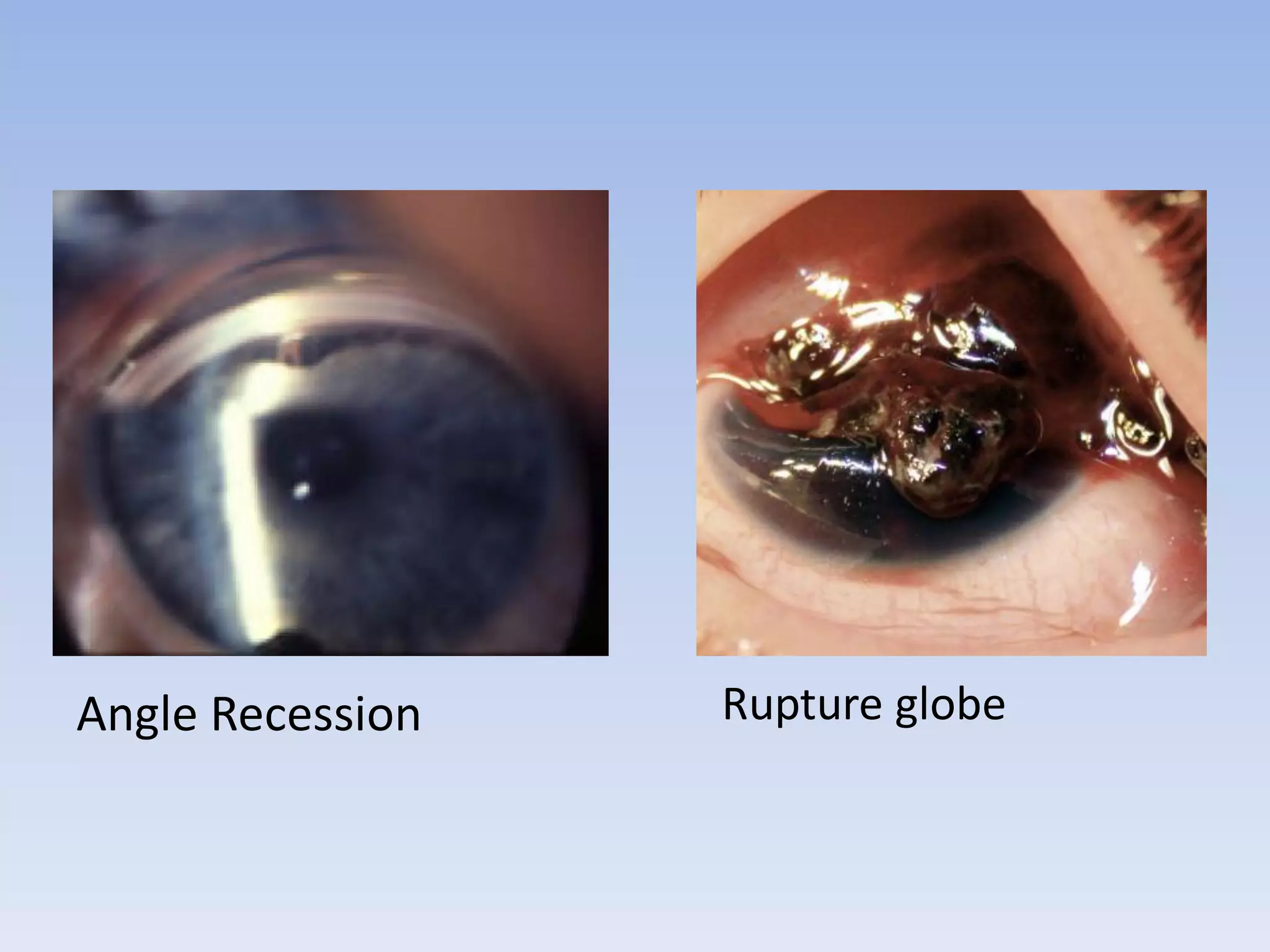 Ocular trauma | PDF