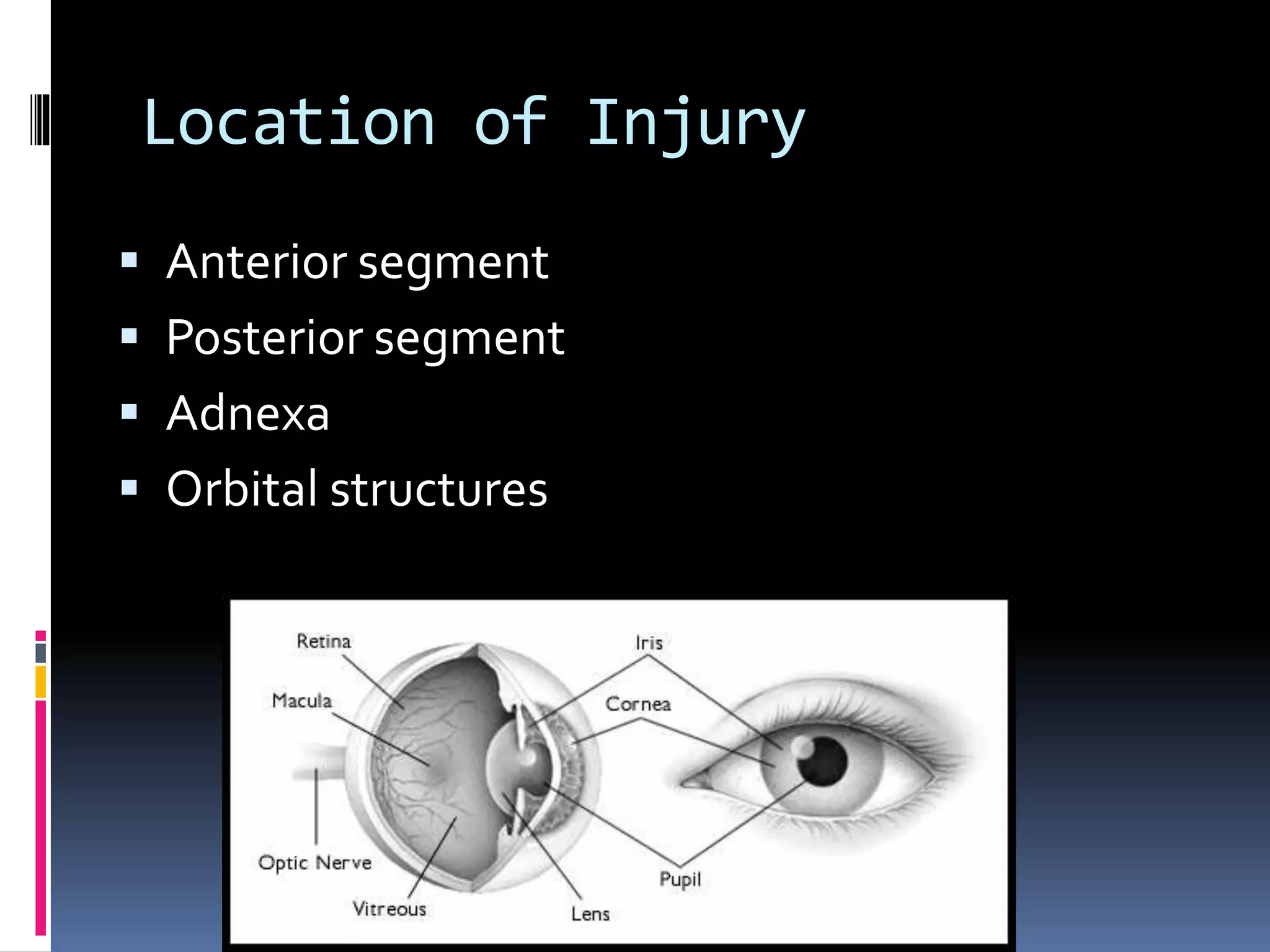 Ocular trauma | PPTX