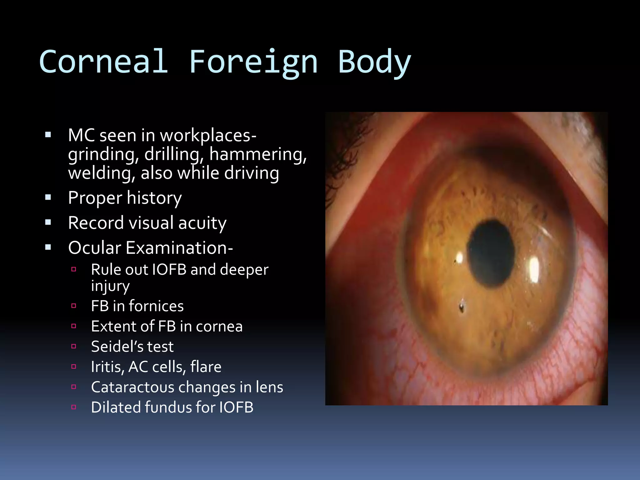 Ocular trauma | PPTX