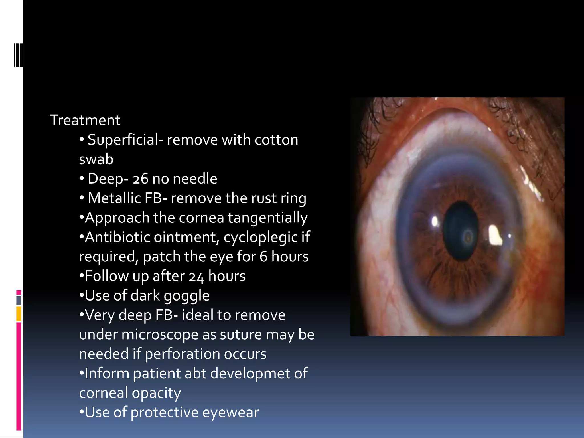 Ocular trauma | PPTX