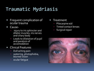 Traumatic Mydriasis