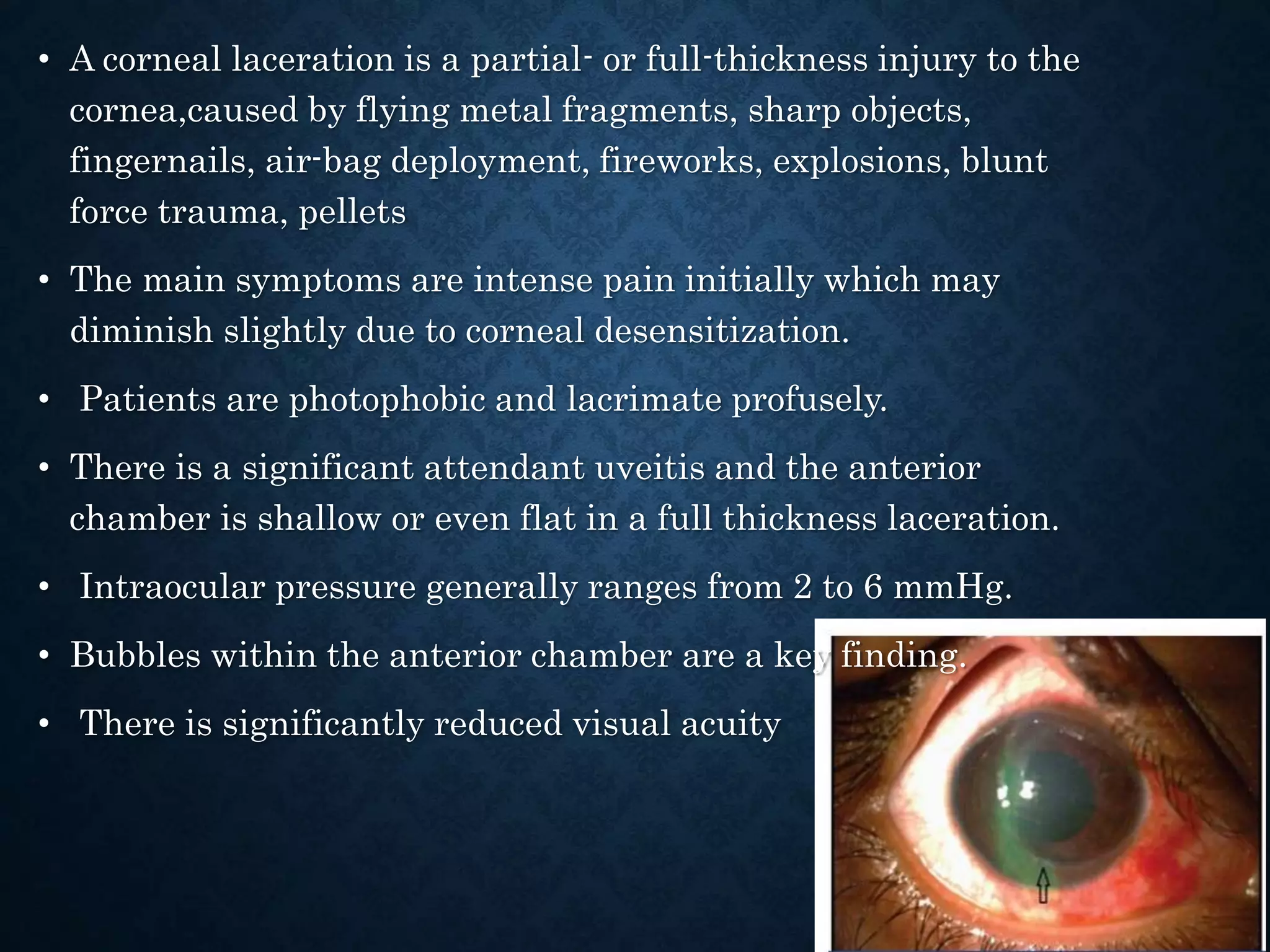 Ocular trauma | PPTX