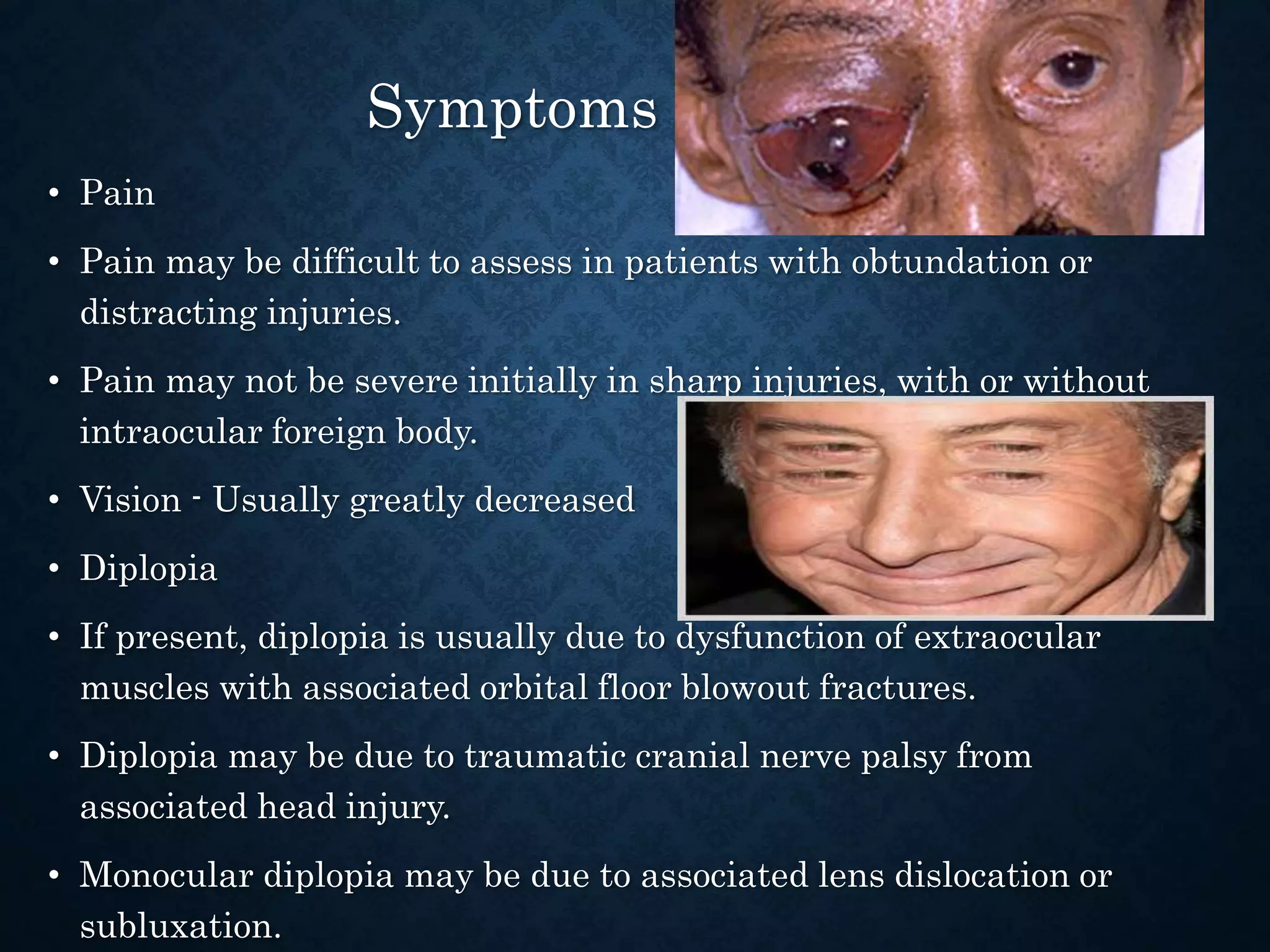 Ocular trauma | PPTX