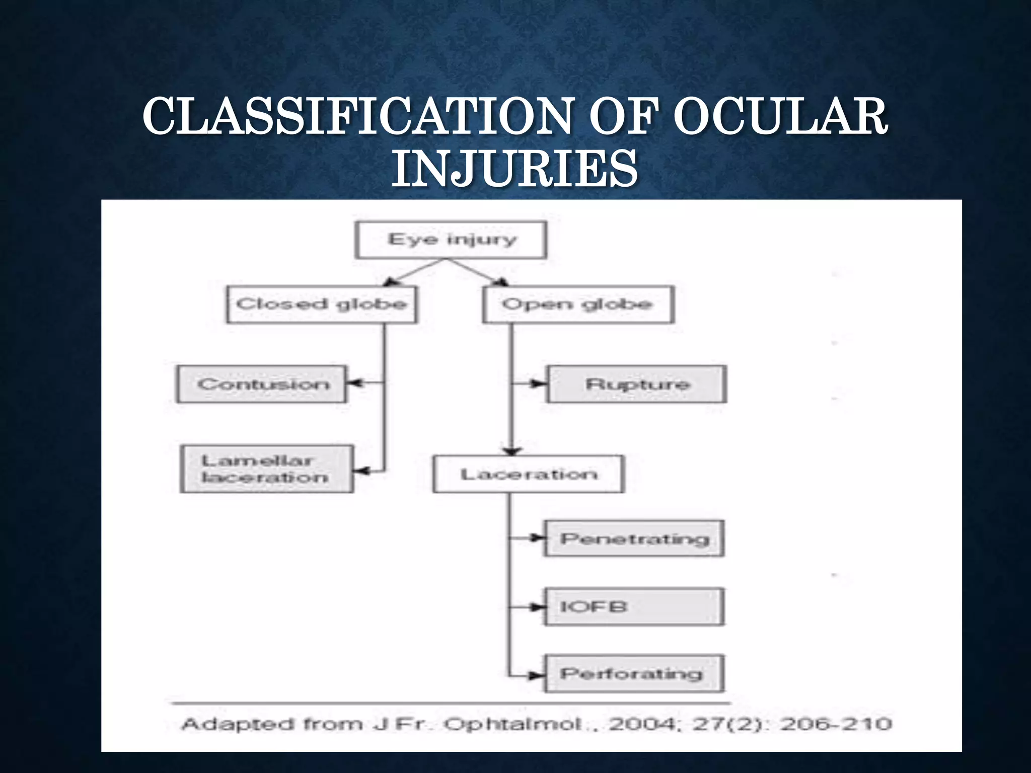 Ocular trauma | PPTX