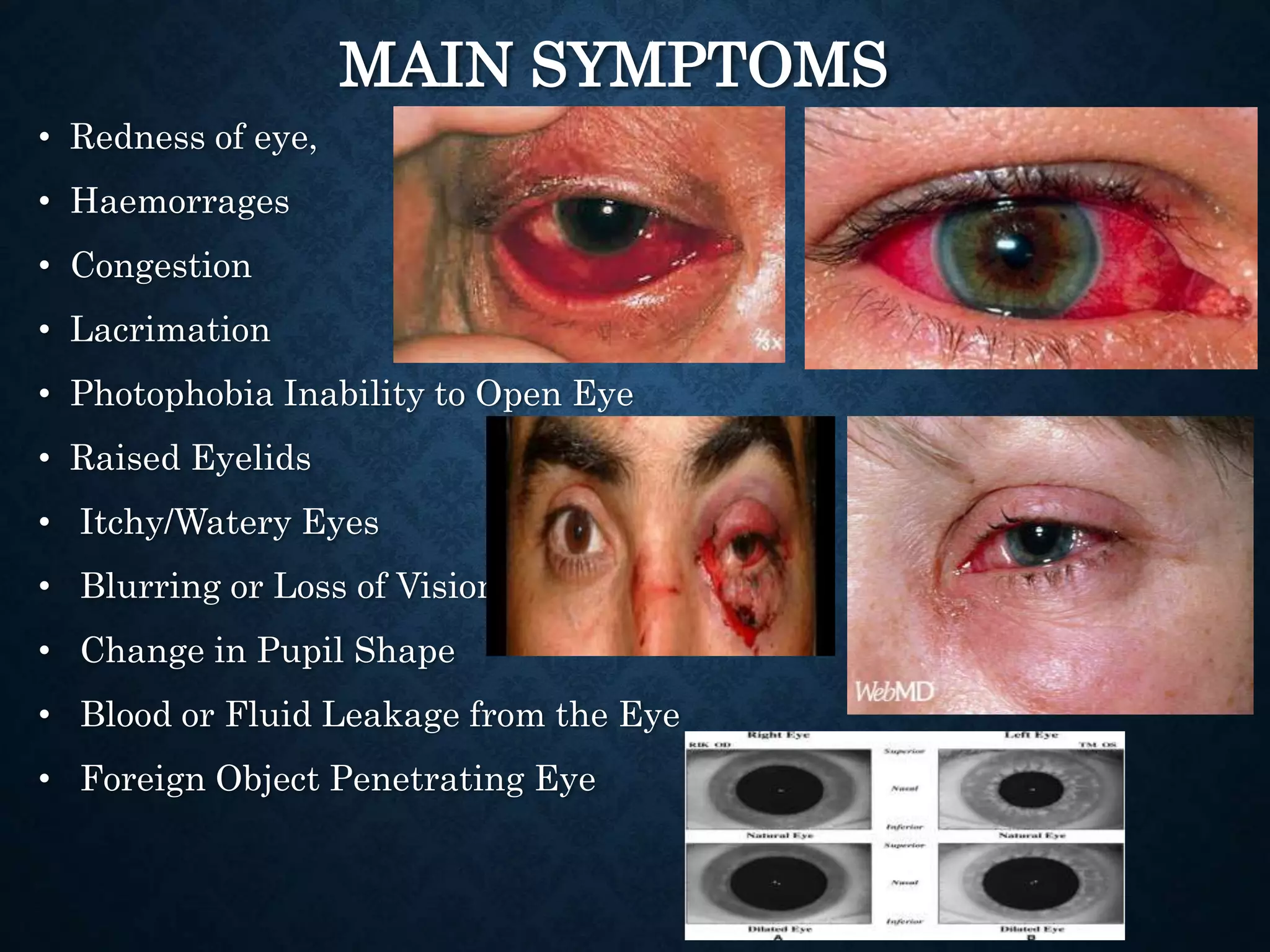 Ocular trauma | PPTX
