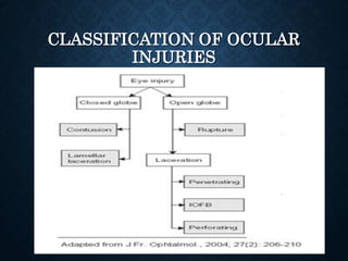 Ocular trauma | PPTX