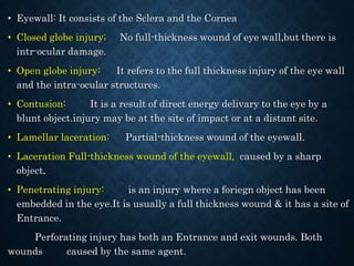 Ocular trauma | PPTX