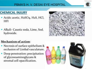 Ocular trauma | PPTX