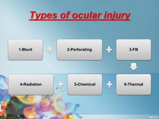 Ocular trauma | PPT
