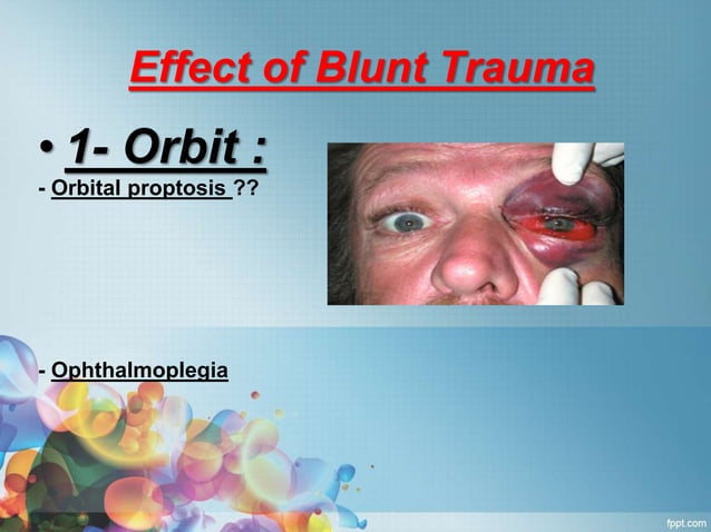 Ocular trauma | PPT