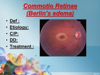 Commotio Retinae Treatment