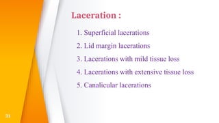 Ocular Trauma | PPTX