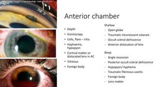 Ocular trauma | PPTX
