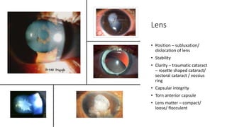 Ocular trauma | PPTX