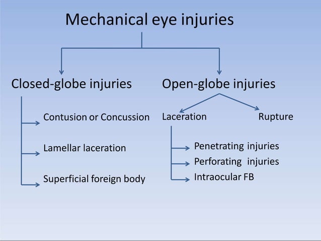 Ocular Trauma , mentioning soft tissue and bony trauma | PPT