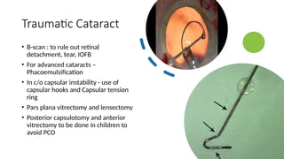 Ocular Trauma/ trauma to eye. .pptx