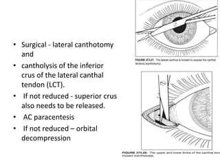 Blunt Ocular trauma | PPTX