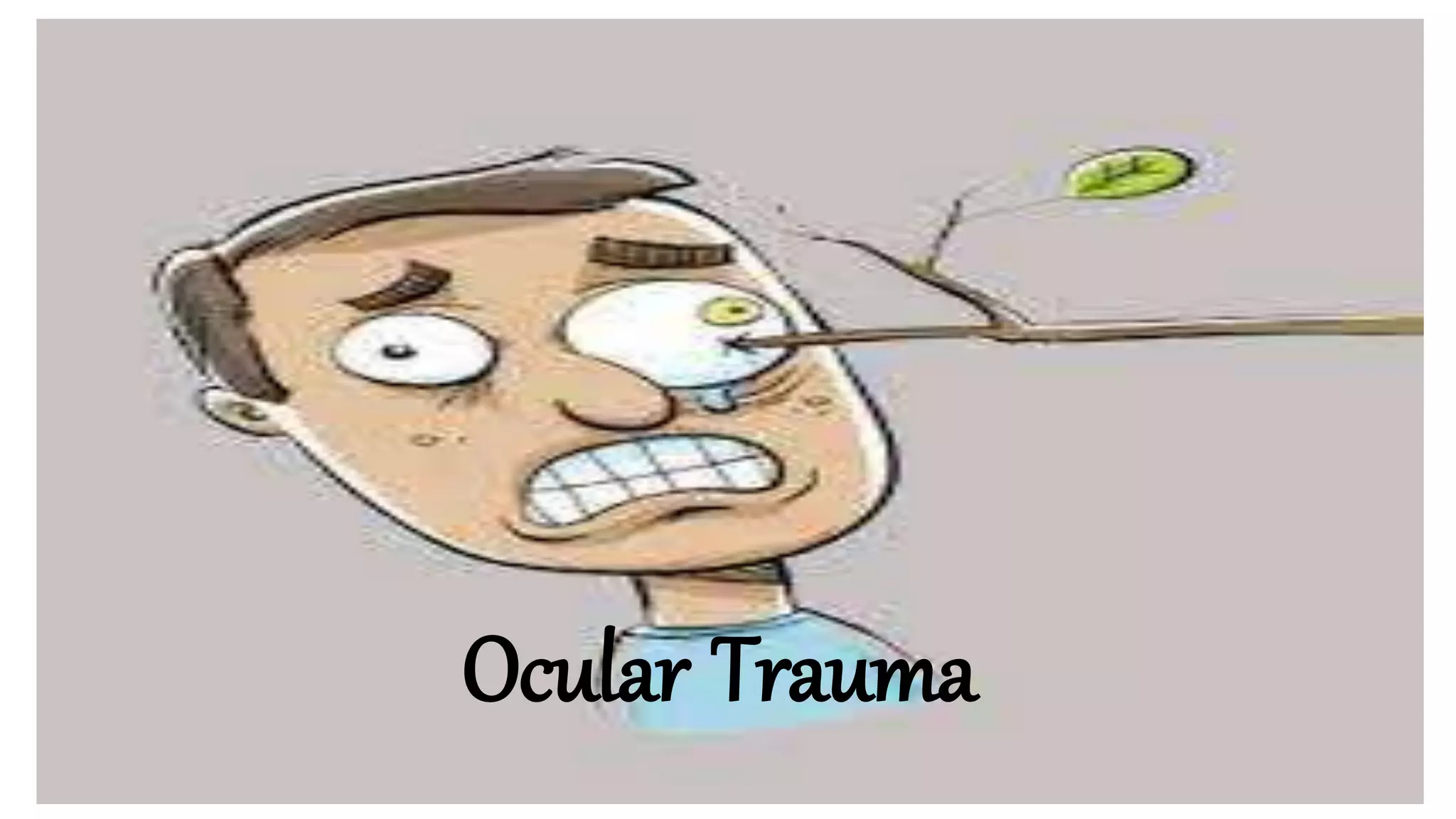 Ocular Trauma .pptx
