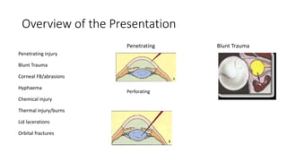 Ocular Trauma .pptx