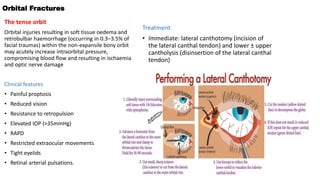 Ocular Trauma .pptx