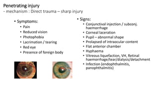 Ocular Trauma .pptx