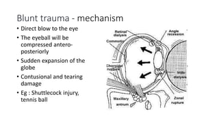 Ocular Trauma .pptx