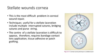 Ocular Trauma - Penetrating and Perforating wounds | PPTX