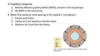 Ocular Trauma - Penetrating and Perforating wounds | PPTX