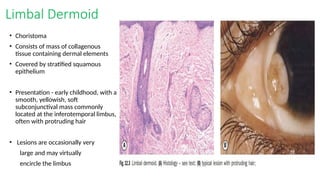 Pathology of Ocular Tumors: Classification, Features | PPTX