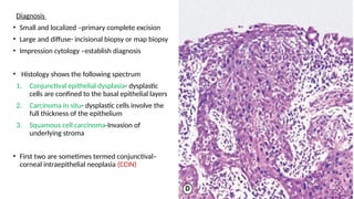 Pathology of Ocular Tumors: Classification, Features | PPTX