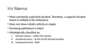 Pathology of Ocular Tumors: Classification, Features | PPTX