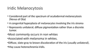 Pathology of Ocular Tumors: Classification, Features | PPTX