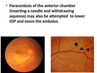 Ocular_Urgencies_and_Emergencies _L.pptx