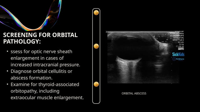 OCULAR Ultrasound IN EMERGENCIES (OUIE).pptx