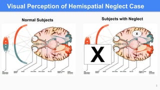 OcuLeft- unilateral neglect App | PDF