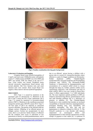 Oculocutaneous Albinism Retina