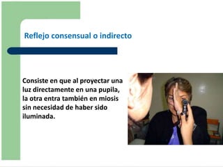 Nervio Oculomotor | PPTX